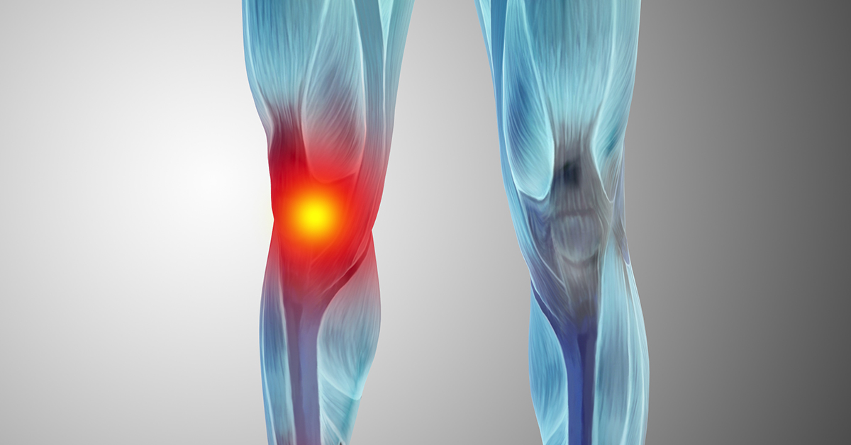 Patellar Tendonitis Jumper s Knee Nashville TN Orthopedic Surgery
